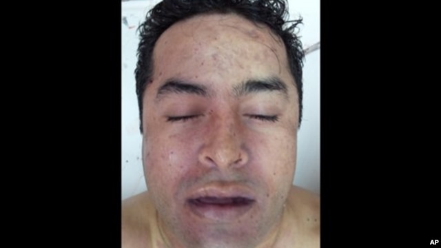 Zetas Cartel Leader Killed Body Snatched