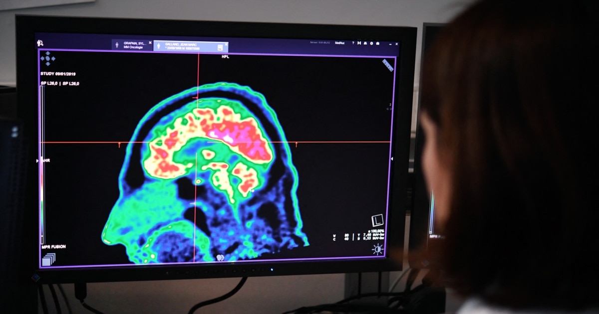 Scientists Use Brain Scans and AI to 'Decode' Thoughts