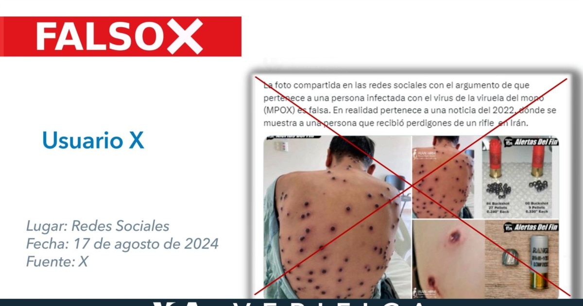 La persona de esta imagen no tiene lesiones por rifle como se dice en X ...