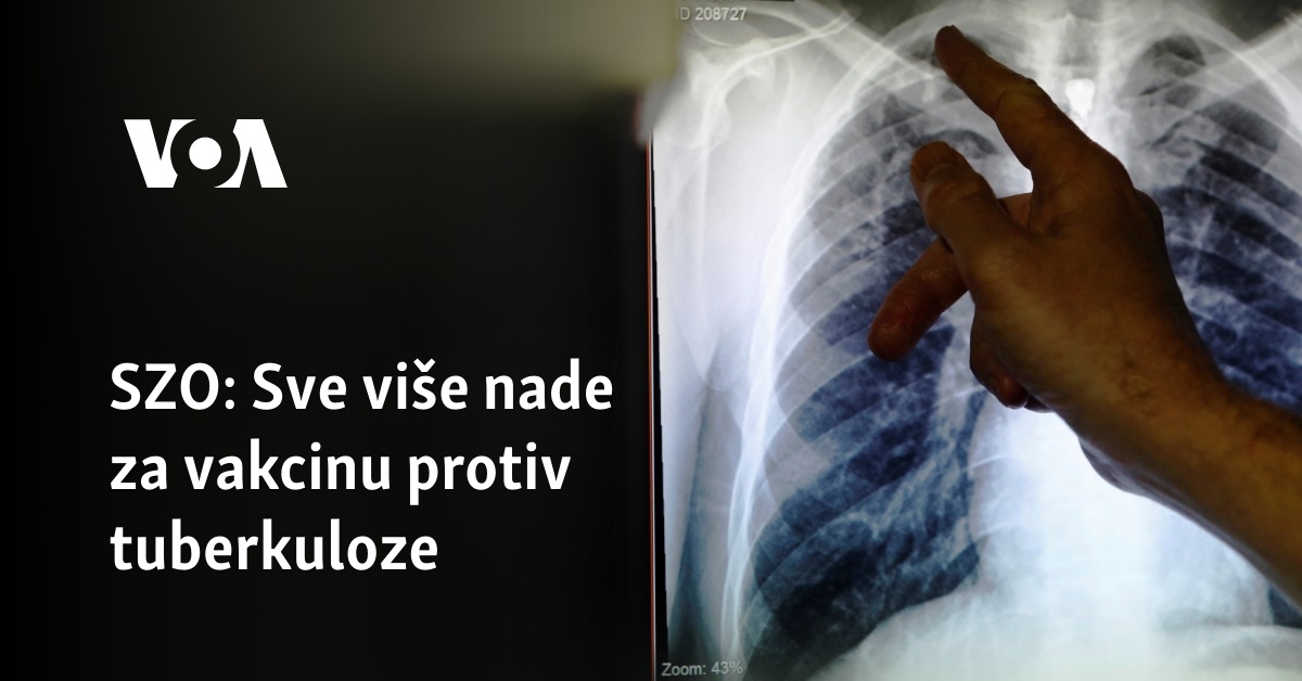 SZO: Sve više nade za vakcinu protiv tuberkuloze