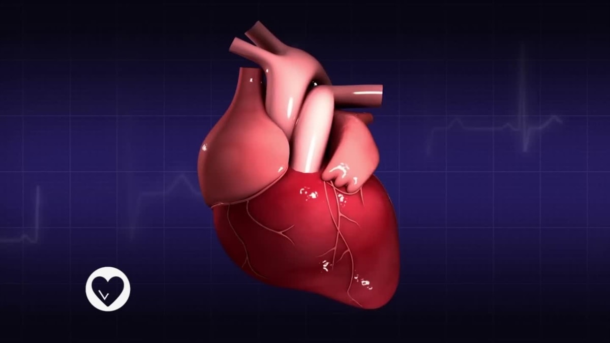 LAFIYARMU: Tsayawar Bugun Zuciya Kwatsam Wata Matsala Ce Da Ke Bukatar ...