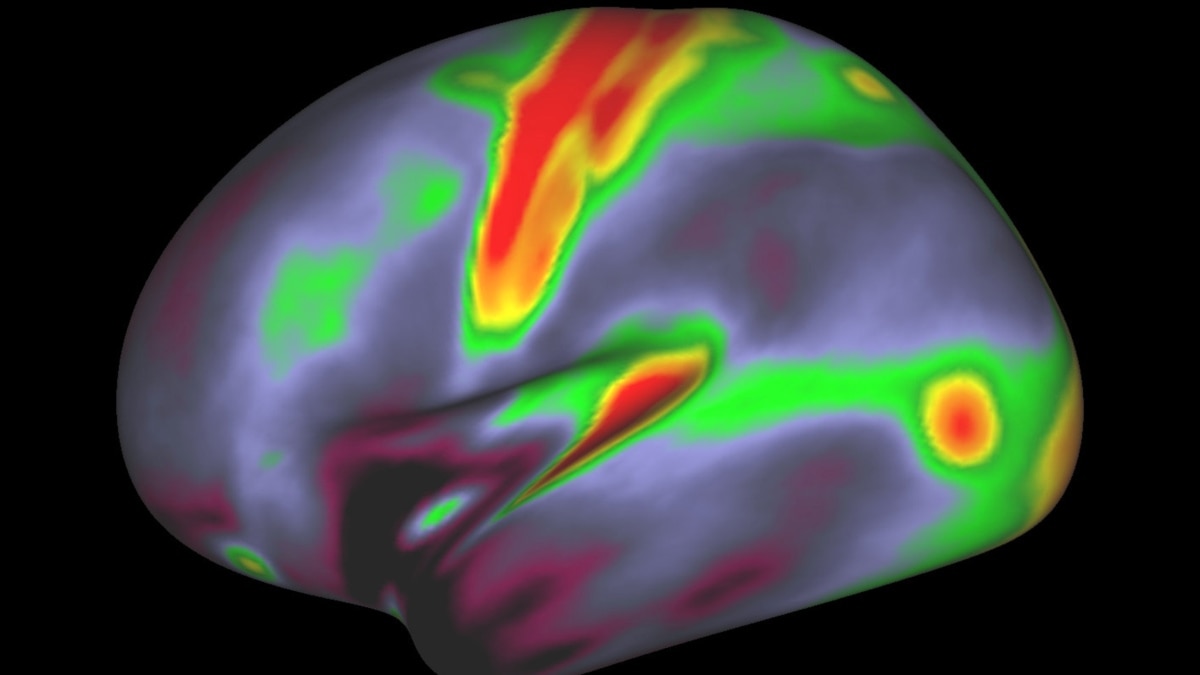 Mind Over Gray Matter: New Map Lays Out Brain's Cerebral Cortex