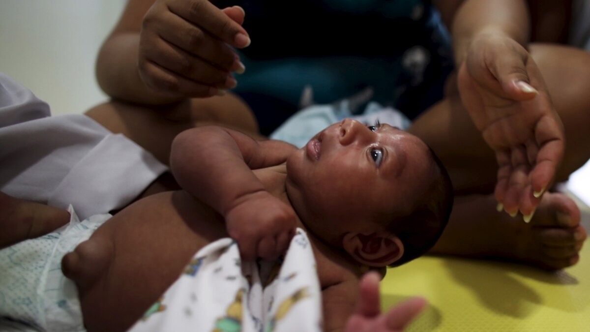 Scientists Inching Closer to Establishing Zika-Microcephaly Link Scientists Inching Closer to Establishing Zika-Microcephaly Link