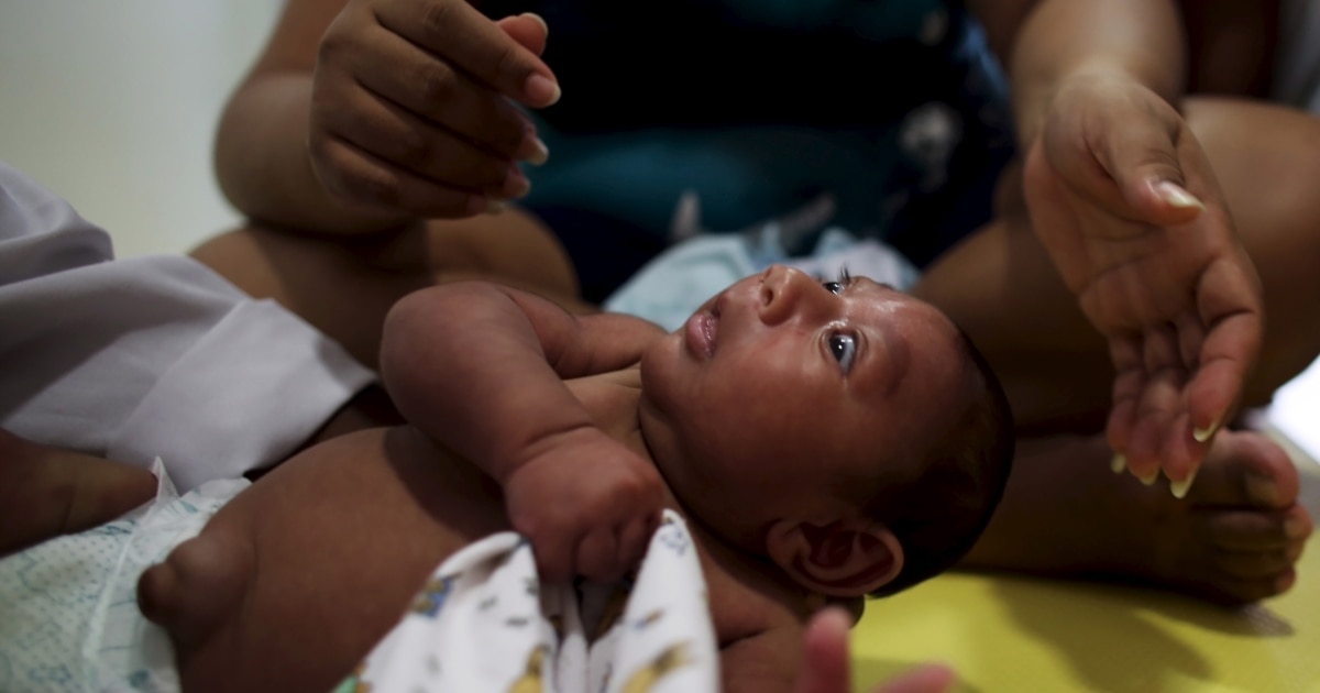 Scientists Inching Closer to Establishing Zika-Microcephaly Link