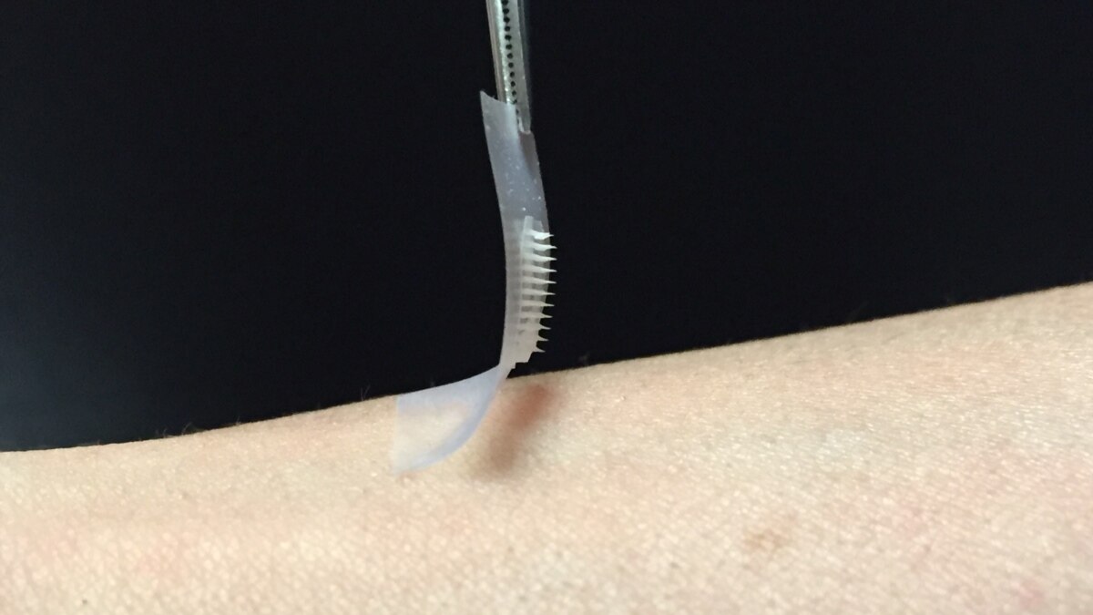 'Smart' Skin Patch Could Improve Diabetes Care