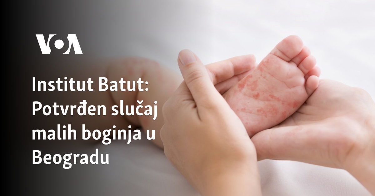 Institut Batut: Potvrđen slučaj malih boginja u Beogradu