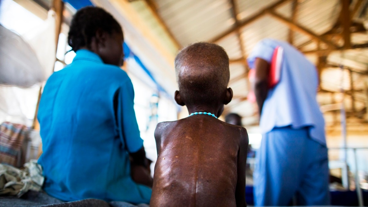 Poor Immune Function May Play Role in Malnutrition, Researchers Suggest