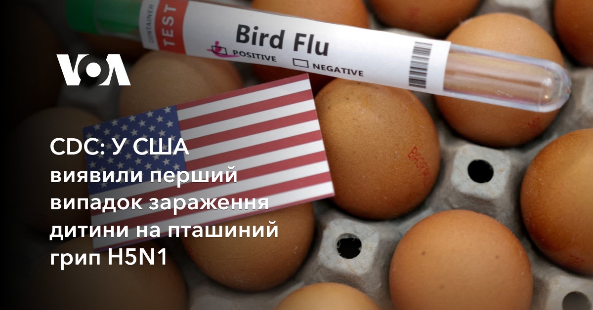 CDC: У США виявили перший випадок зараження дитини на пташиний грип H5N1