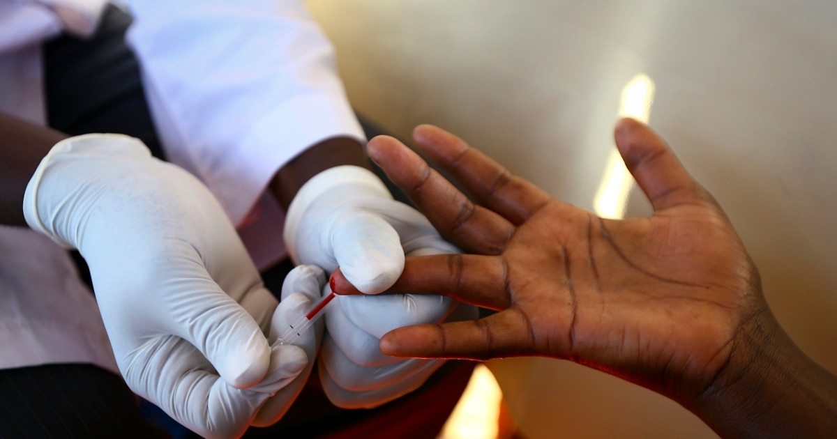 Scientists Achieve 'Functional Cure' for HIV in Monkey Model