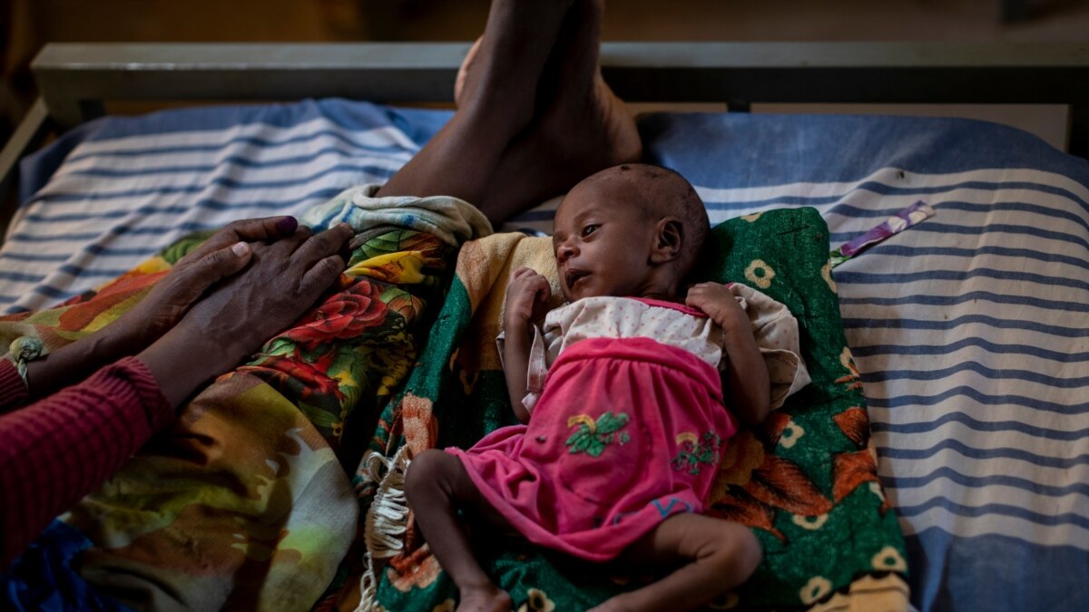 Millions in 23 Hunger Hot Spots Face Famine, Death, UN Agencies Say