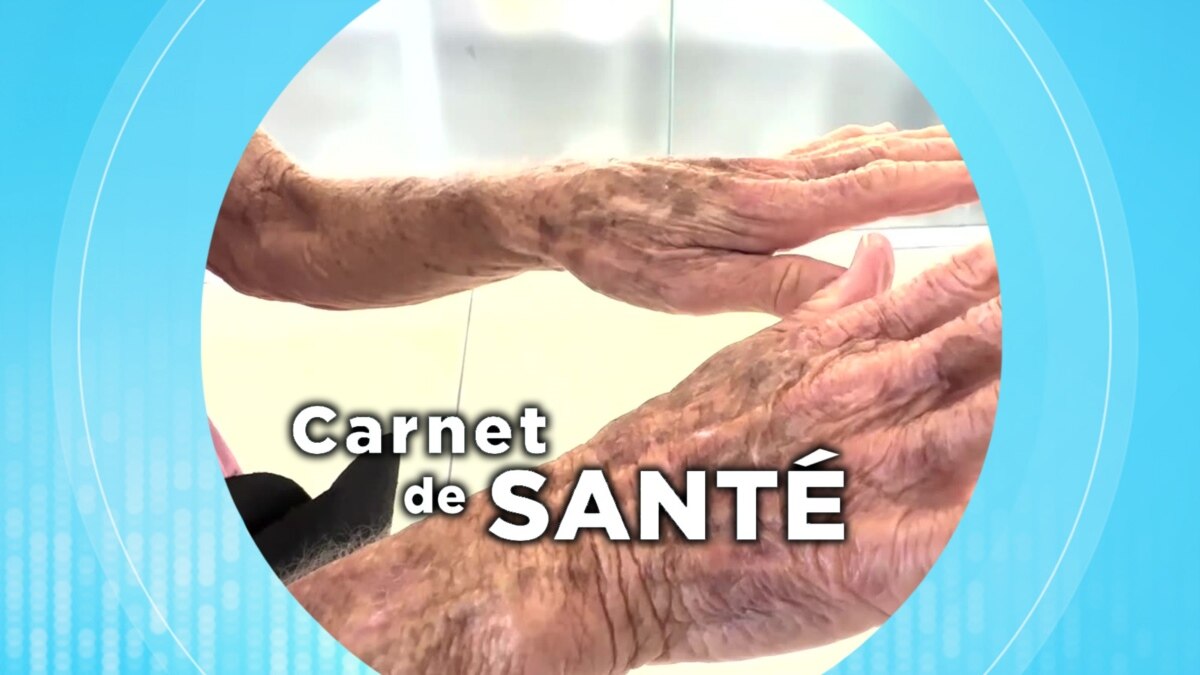 Carnet de Santé : un regard sur l'arthrite