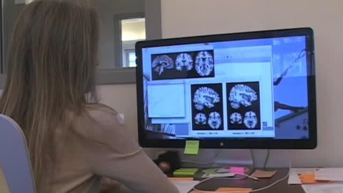 Brain Scan Database Aims to Accelerate Chronic Pain Research