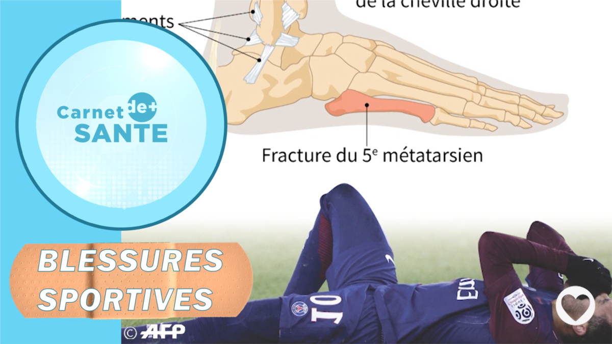 Carnet de santé : les blessures sportives