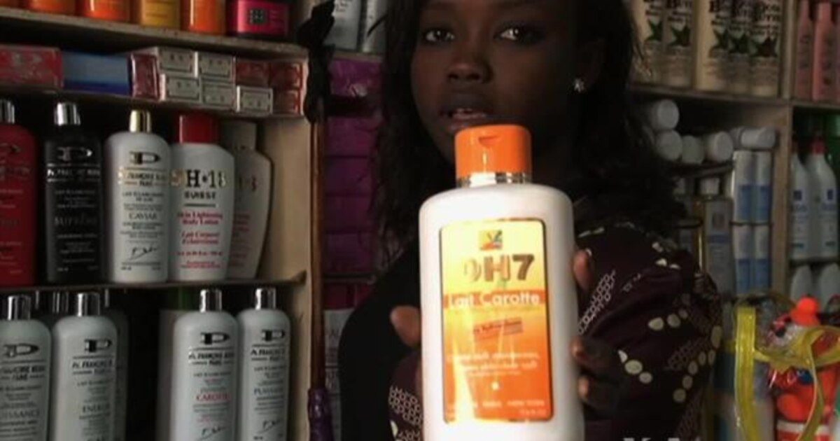 In Senegal, Skin-Lightening Remains Popular Despite Health Risks