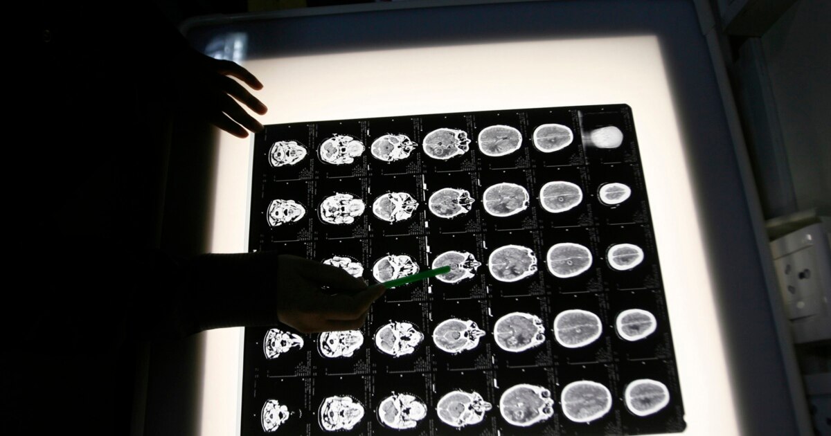 Scientists Using Polio To Treat Brain Cancer