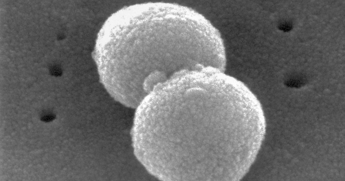 US Health Officials Call for Shots Against Pneumonia