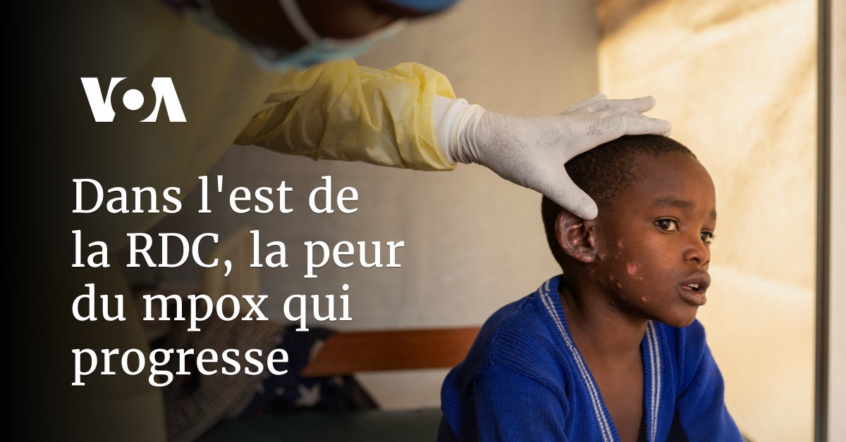 Dans l'est de la RDC, la peur du mpox qui progresse