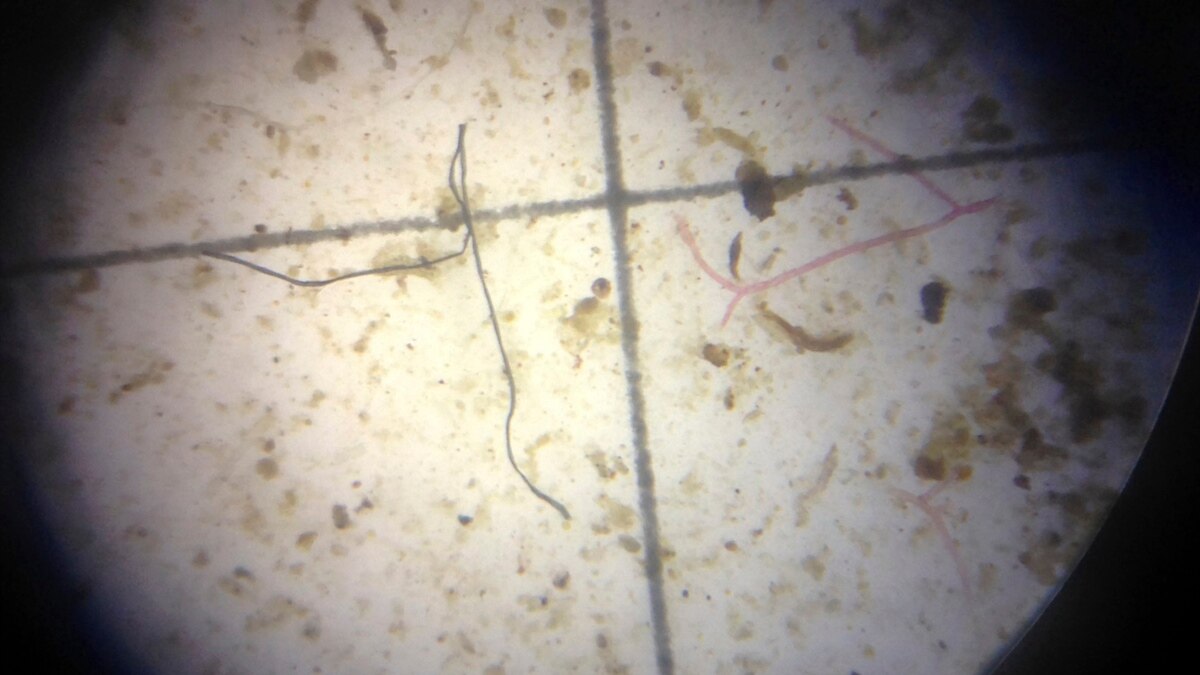 Products Take On Microfiber Pollution, a Laundry Room at a Time