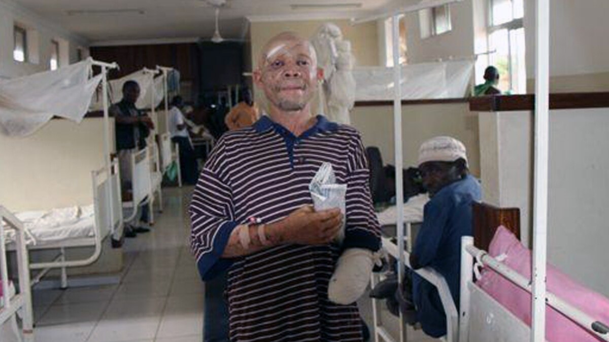 UN Official Issues Urgent Call for Protection of People With Albinism