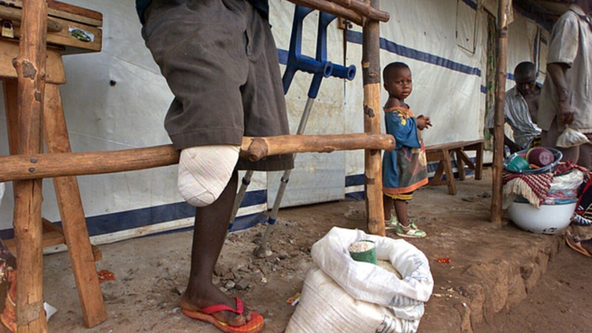 Angola: Deficientes continuam marginalizados, dizem activistas