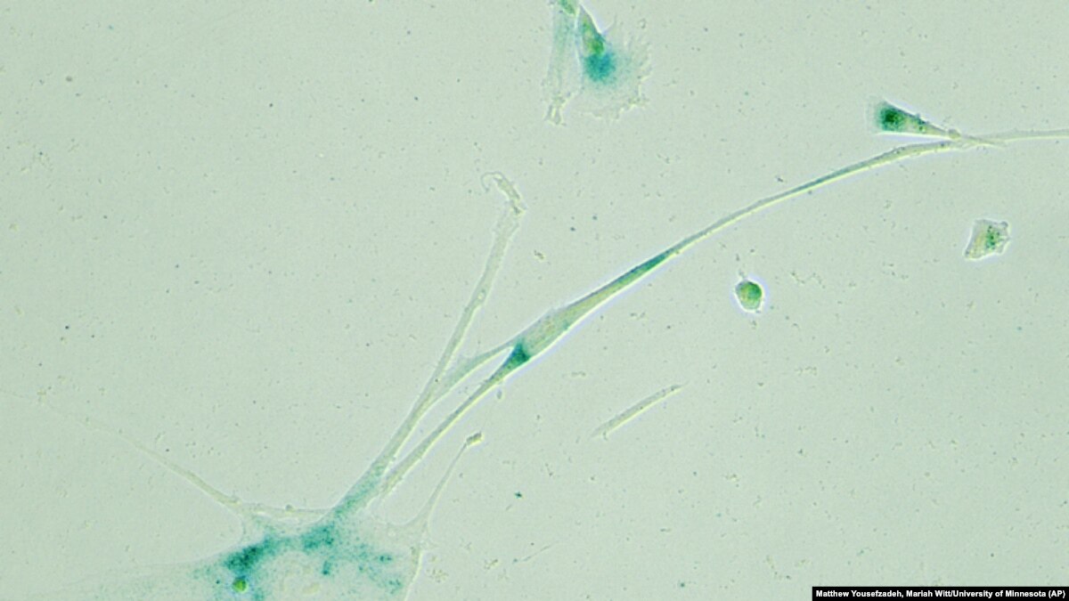 ‘Zombie Cells’: Researchers Fight Aging Process of the Human Body