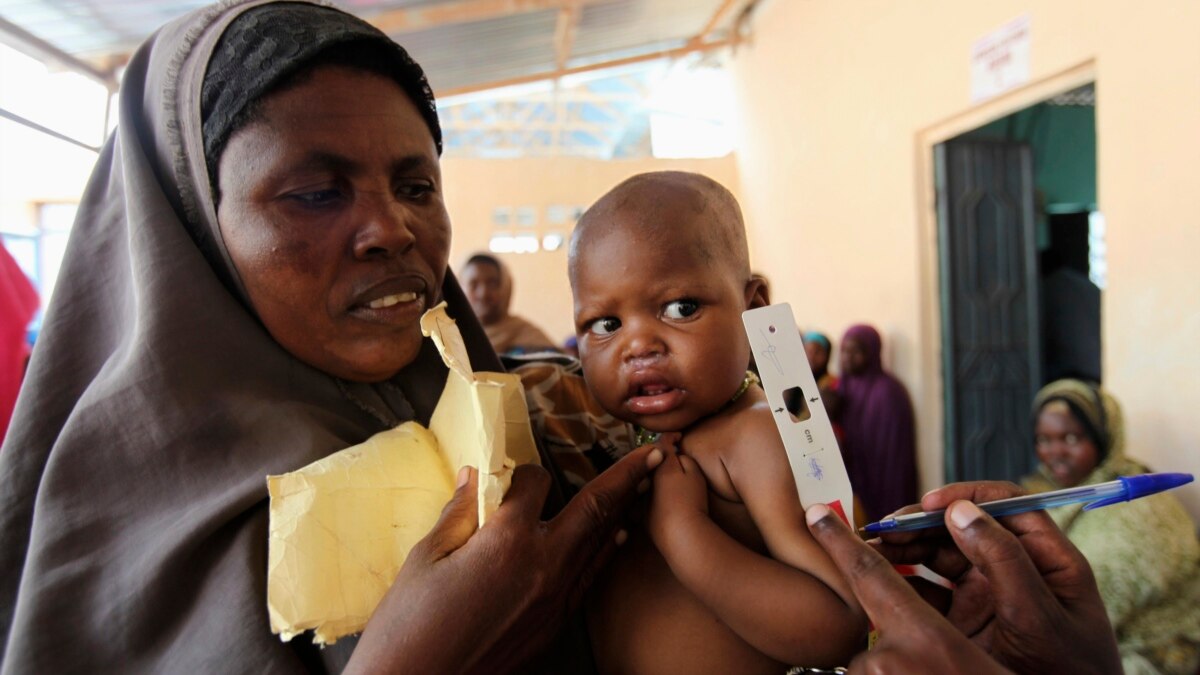 Report: Child Malnutrition Costs Global Economy Billions