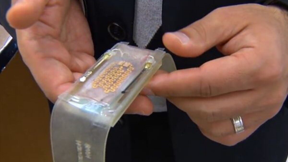 Smart Bandages to Heal Wounds More Quickly