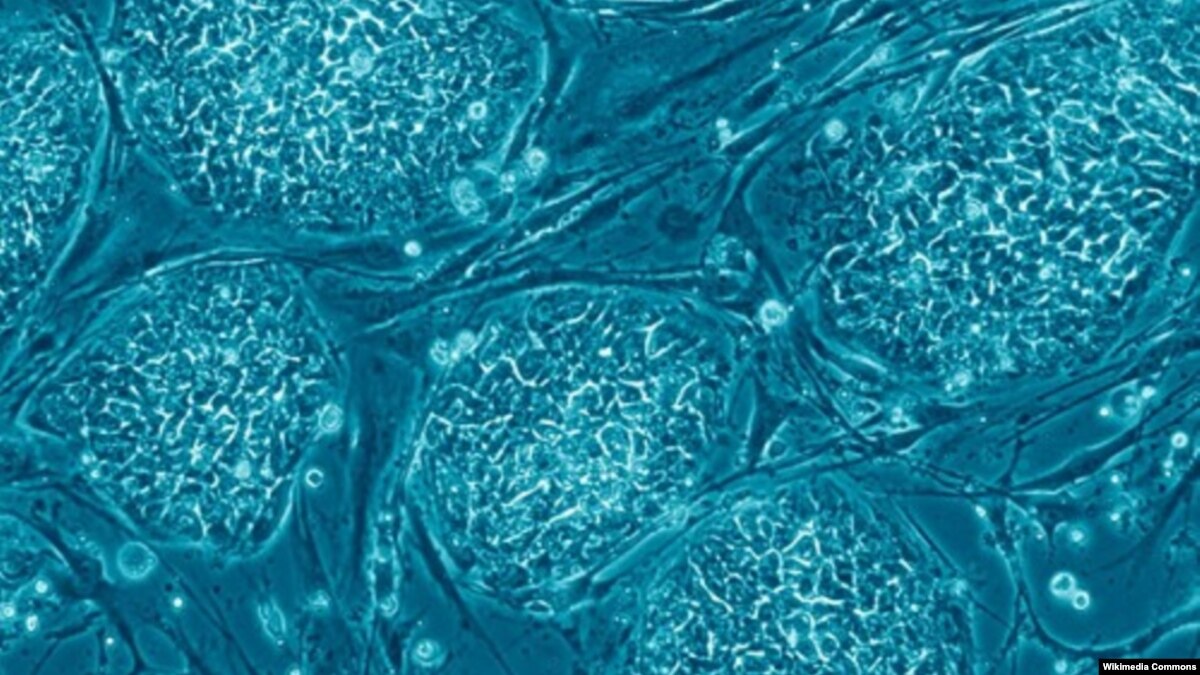 Study Identifies Stem Cells as Cancer Source Study Identifies Stem Cells as Cancer Source