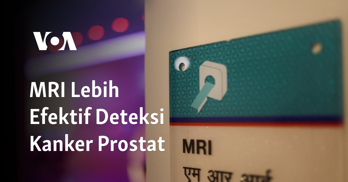 MRI Lebih Efektif Deteksi Kanker Prostat