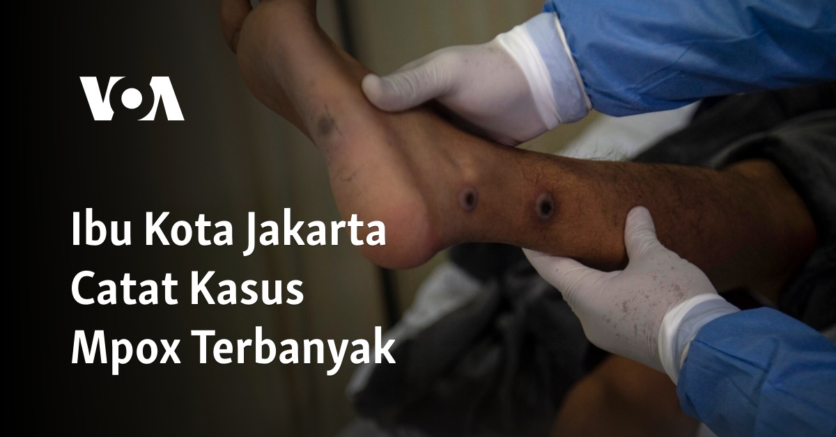 Ibu Kota Jakarta Catat Kasus Mpox Terbanyak
