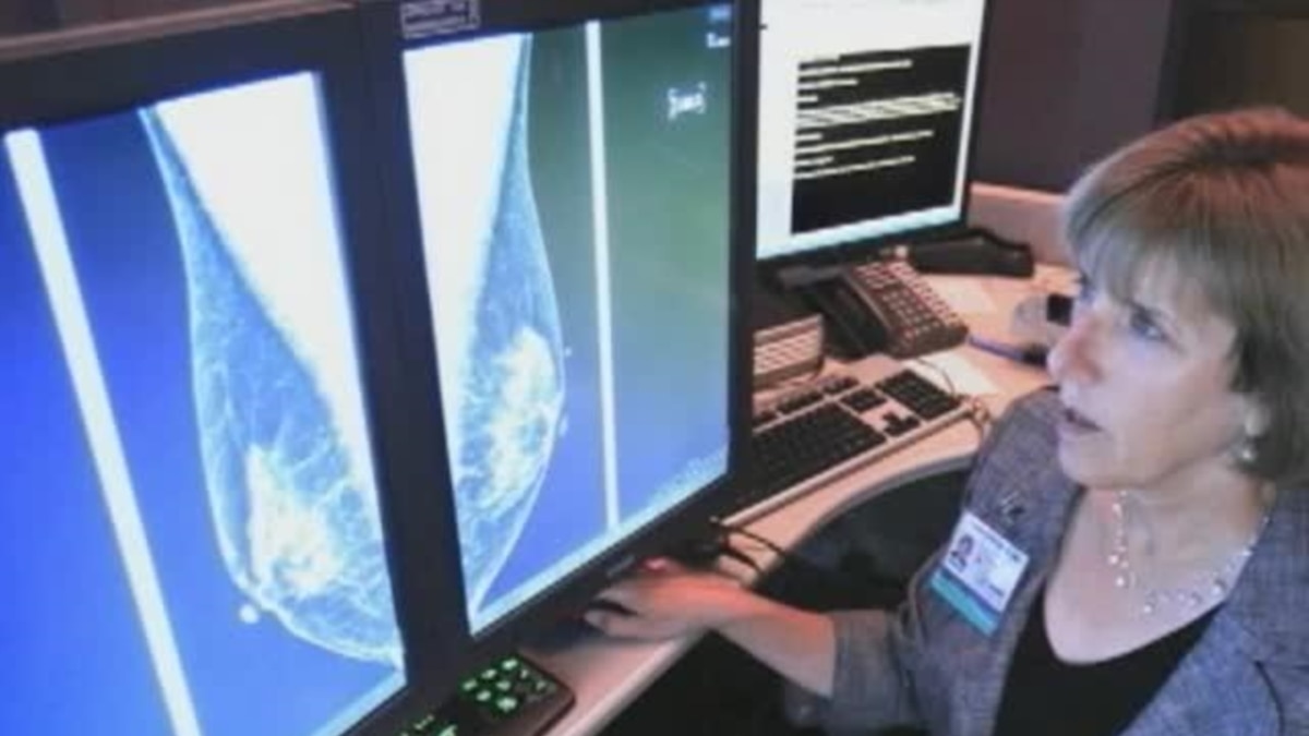 Study Questions Value of Mammograms