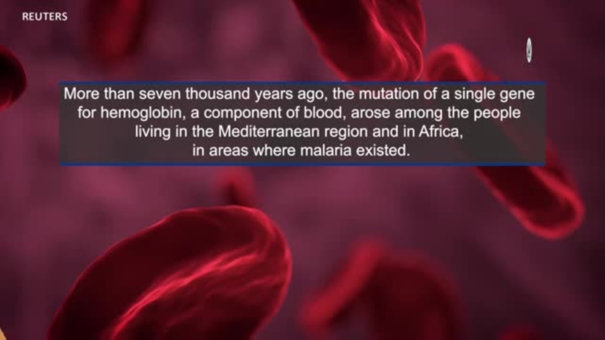 Tackling Sickle Cell Disease in Africa