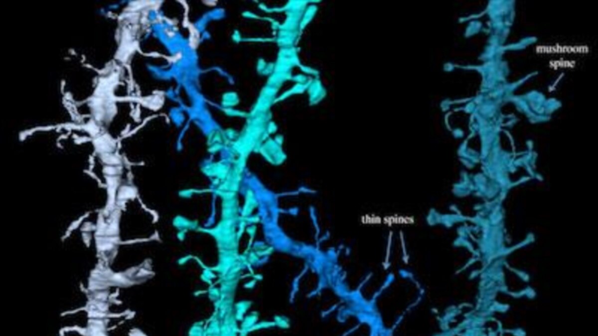 Sleep Shrinks Synapses, Preps For New Learning