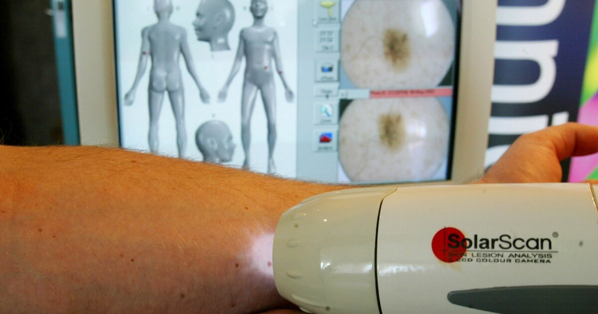Famous Australian Skin Cancer Ad Returns to the Airwaves
