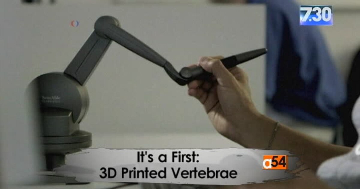 3D printed body parts
