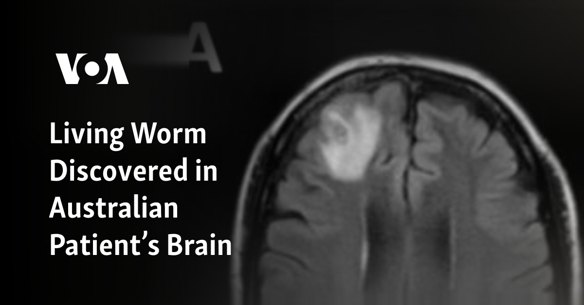Living Worm Discovered in Australian Patient’s Brain