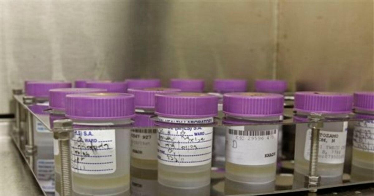 Health: UK Researchers Identify New TB Markers