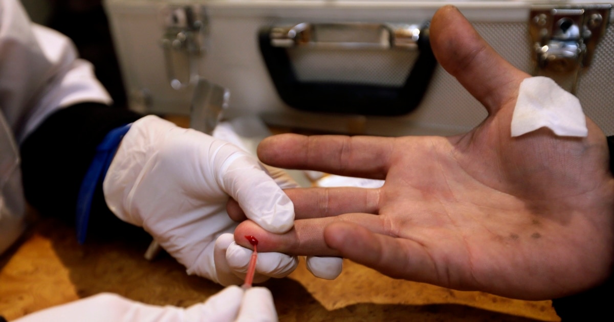 Tes Baru Temukan HIV yang Tersembunyi