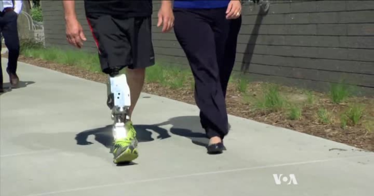 Researchers Develop Artificial Legs That Mimic Real Ones