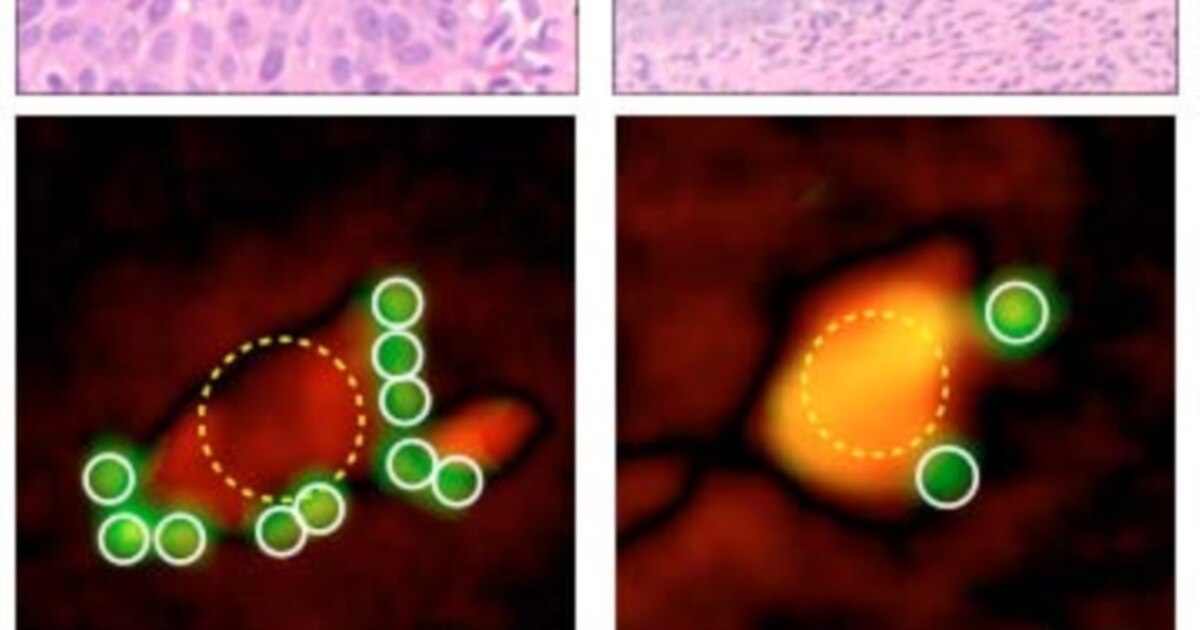 Omama Abakuhlelo lweART Therapy Bakhuthazwa Ukuhlolwa Imvukuzane ...